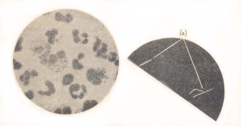 Medical Facts About V.D.